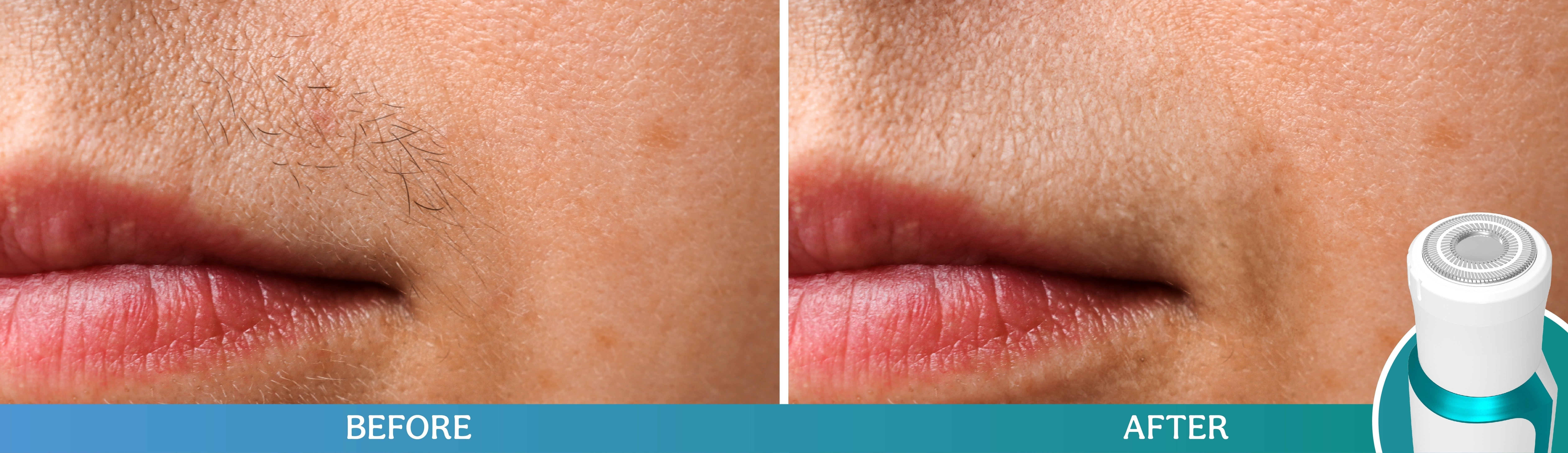 Buy Face & Body Hair Trimmer Online at Best Price | Caresmith